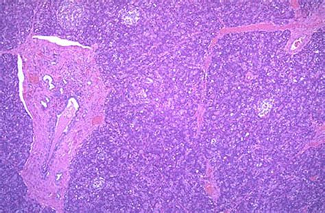 Normal Histology