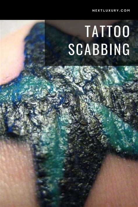 Tattoo Scabbing All You Need To Know Tattoo Scabbing Tattoo Healing
