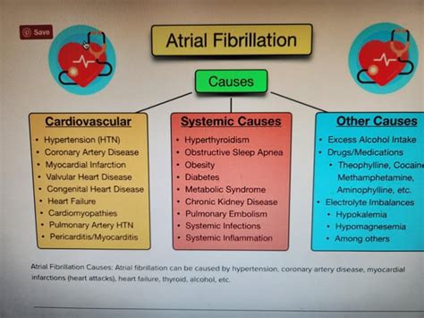 Vagal Paroxysmal Afib Here Any Others On This Forum Would Love To