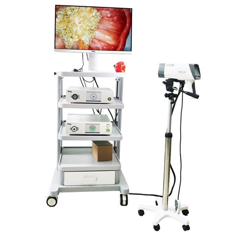 Vaginal Colposcopy Imaging System Medical Portable Digital Colposcopy