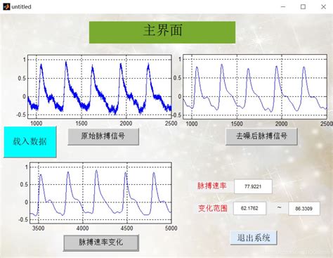 【肌电信号】基于matlab Gui脉搏信号分析去噪特征提取【含matlab源码 862期】脉搏信号的特征分析matlab Csdn博客