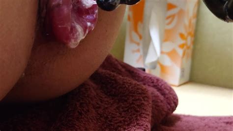 アナル吸引 アナルローズ拡張 Free Sex Video RedTube