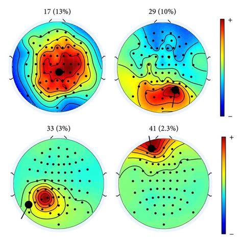 Scalp Maps Of The Pwc Ica 1 Haar Components With The Best Absolute