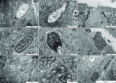 Detailed Tem Micrographs Of Goblet Cells Rodlet Cells Lymphocytes