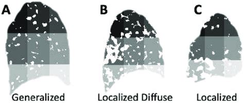Samples Of Excess Fluid Spatial Presentation Groups A Is A Download Scientific Diagram
