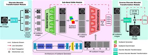 Figure 1 From Fine Perceptive Gans For Brain Mr Image Super Resolution In Wavelet Domain