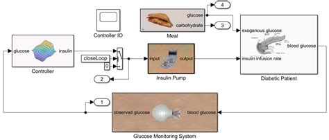 design controller for artificial pancreas using fuzzy logic matlab