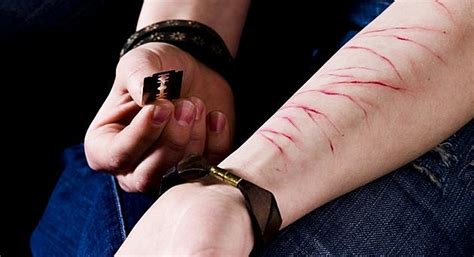 Dermatitis Artefacta Ugeskriftetdk