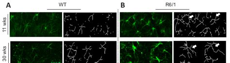 Histological Evaluation Of Astrocyte Density And Complexity