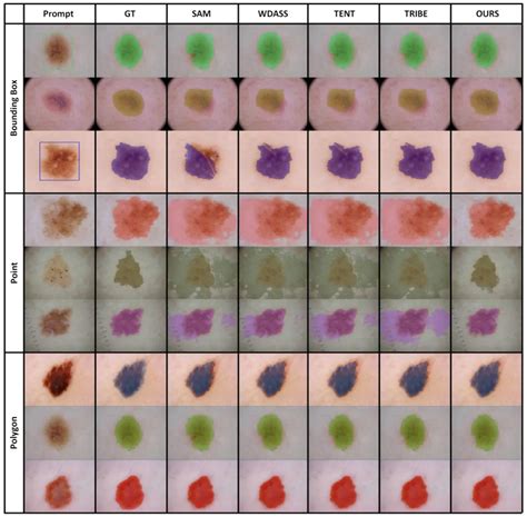 Cvpr 2024 分割一切模型sam泛化能力差？域适应策略给解决了 Aix Aigc专属社区 51ctocom
