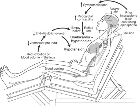 Beach Chair Position Anaesthesia Interior Interractive