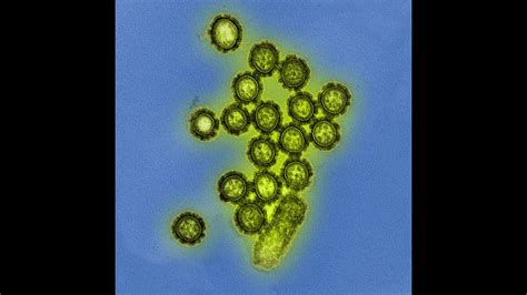Cyanobacteria Under Microscope