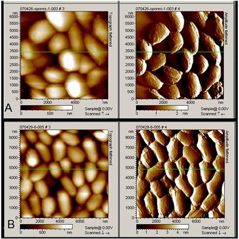 A B Anthracis Exosporium Fragments And The B Anthracis Spores After