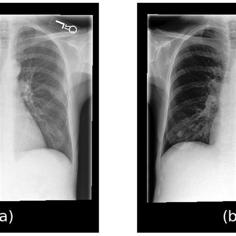 Example Of An Image Converted From DICOM A To JPEG B Download Scientific Diagram