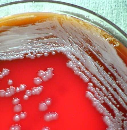 Differential Selective Media Definition Examples Lesson Study