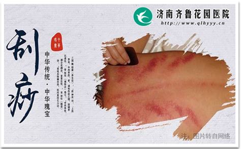 刮痧对身体的好处有哪些济南齐鲁花园医院