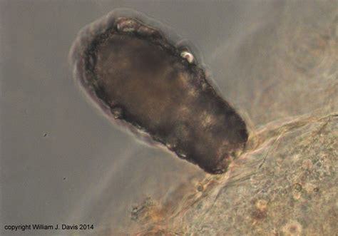 Wandering Naturalist Protist Love 1 Difflugia
