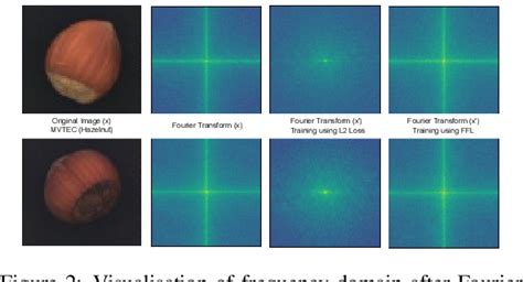 figure 1 from robust semi supervised anomaly detection via