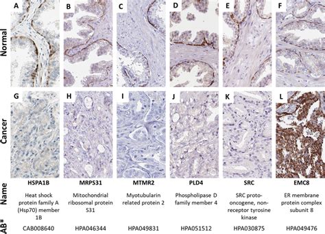 Identification Of New Biomarkers For The Basal Cells Of The Prostate