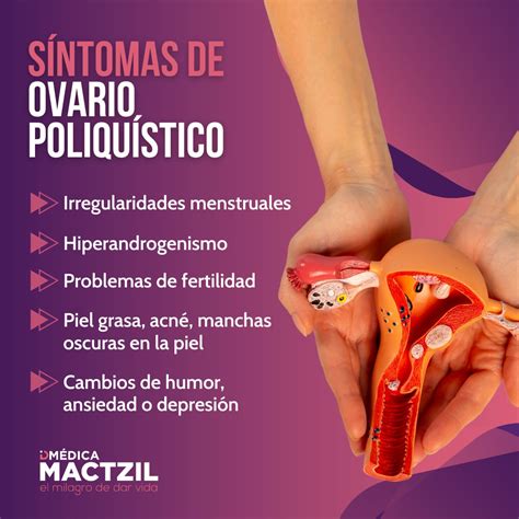 Idmedica Mx Conoce Los Principales Síntomas De Ovario Facebook