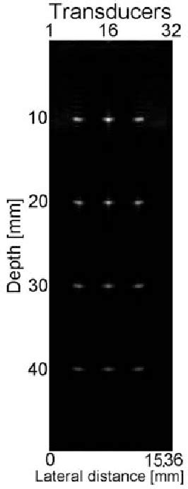 Figure 4 From Synthetic Transmit Aperture In Ultrasound Imaging Semantic Scholar