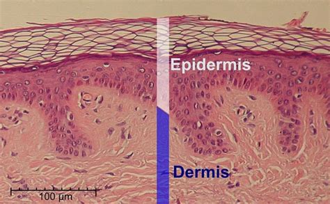 What Is The Difference Between Epidermis And Hypodermis Pediaa Com