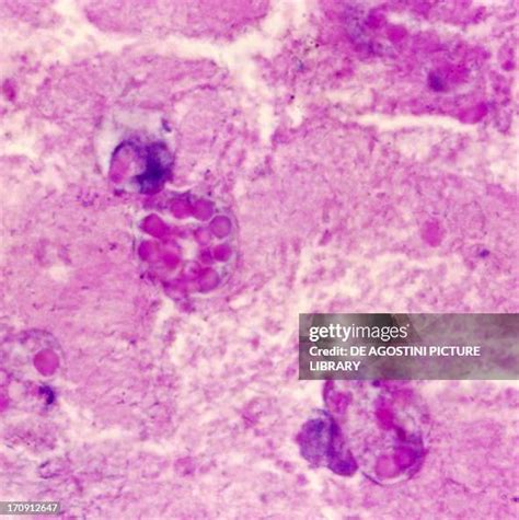 Amoeba Entamoeba Histolytica Seen Under A Microscope At X630 News