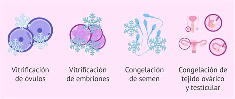 Métodos Para Preservar La Fertilidad