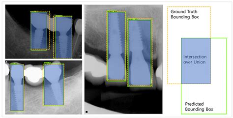 Schematic Diagram Showing The Concept Of Iou The Area Where The Ground Download Scientific