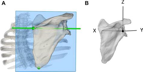 Three Dimensional Scapular Orientation A Comparison Of Glenohumeral