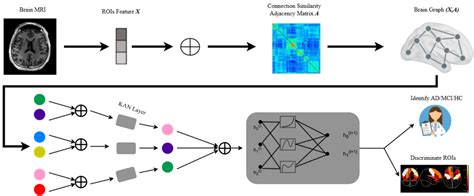 論文レビュー Gkan Explainable Diagnosis Of Alzheimers Disease Using Graph Neural Network With