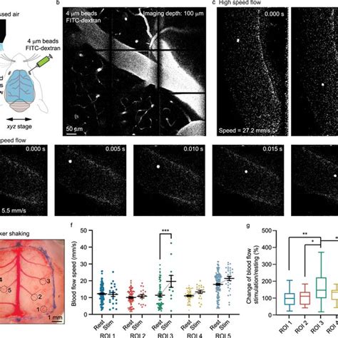 In Vivo 2d High Speed Imaging Of Neuronal Structures A Experiment