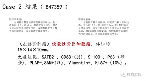 【病例】髂骨浆细胞瘤 Vs 侵袭性骨巨细胞瘤 影像ppt