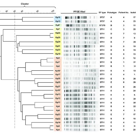Pfge Results And Mlst Typing For 29 K Pneumoniae Isolates Genomic