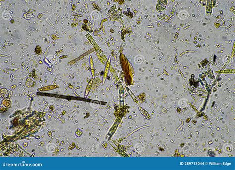 Microorganisms Under A Microscope For Fuel Cell Research Royalty Free