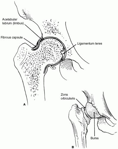 Arthrogram Hip Radiology Key