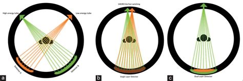 Dual Energy Computed Tomography Of The Abdomen A Reliable Trouble