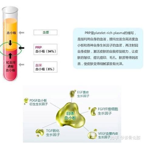 prp是什么PRP注射膝关节是什么 知乎