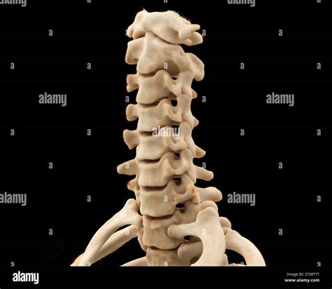 Ct Scan Of C Spine Or Cervical Spine 3d Rendering For Diagnosis Fracture Of Cervical Spine In
