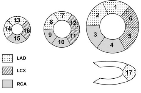 Standard 17 Segment Model Each Major Vascular Territory Was Attributed
