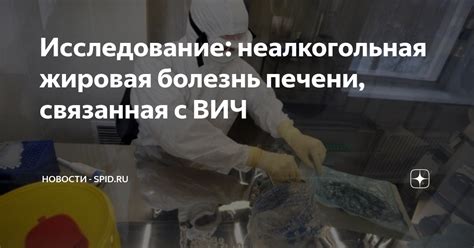 Исследование неалкогольная жировая болезнь печени связанная с ВИЧ Новости Spid Ru Дзен