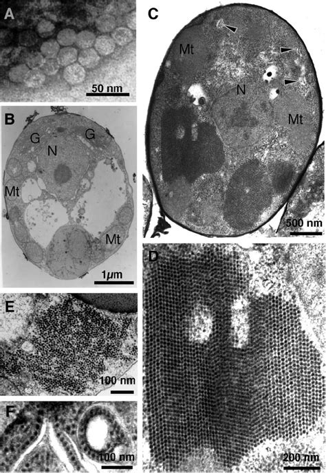 Transmission Electron Microphotographs Of Schizochytrium Sp Strain