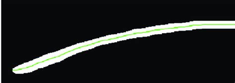 Green Colored Central Curvature Of Corneal Segmentation Download Scientific Diagram