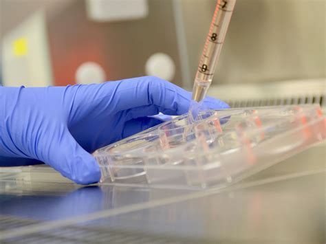 Biomedical Science Course With Bsc Hons Degree Rgu University Aberdeen Scotland Uk Rgu