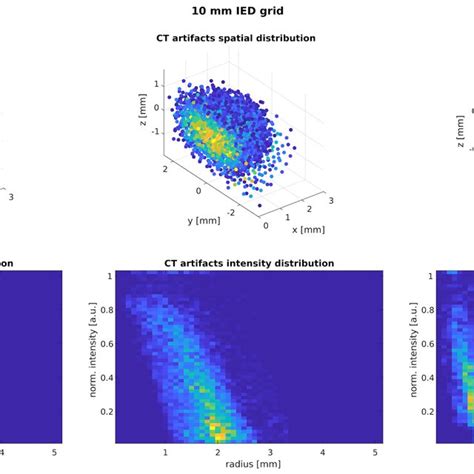 Spatial Distribution Of Ct Artifacts In Three Exemplary Patient Cases Download Scientific