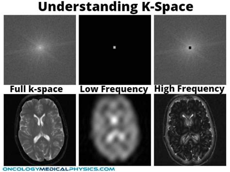 Magnetic Resonance Imaging Oncology Medical Physics