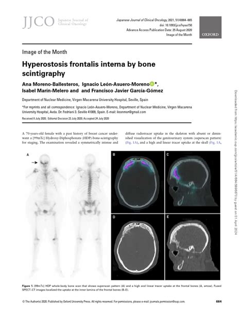 Bone Pdf Radioactive Tracer Menopause