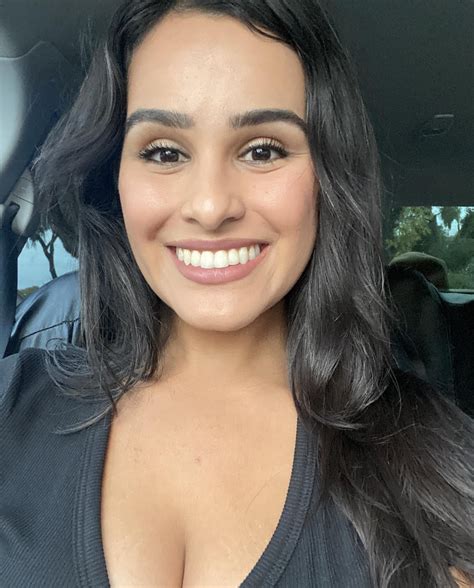 It Gets Better 9 Months Post Op Class Iii Rjawsurgery