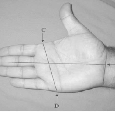 PDF Sex Determination From Hand Dimensions And Index Ring Finger Length Ratio In North Saudi