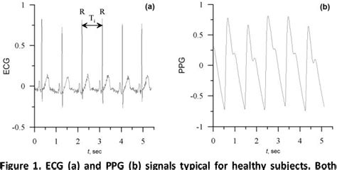 Figure 1 From Method Of Estimation Of Synchronization Strength Between Low Frequency